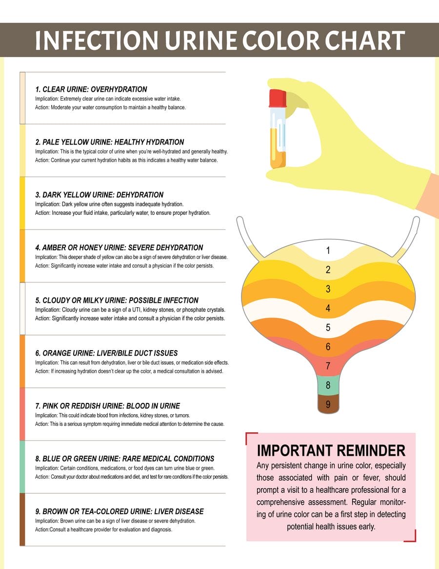Printable Dehydration Urine Color Chart - WordLayouts